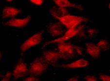 TraKine™ Cell Plasma Membrane Staining Kit (Orange Fluorescence ...