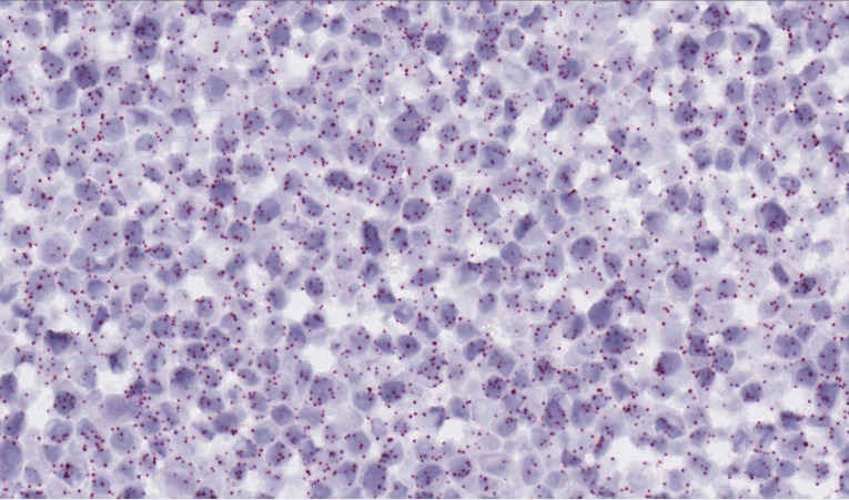 Control Probes for Manual Assays - RNAscope 2.5 HD Assay (BROWN and RED ...