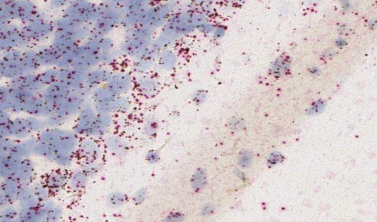 RNAscope® Multiplex Fluorescent Assay Options,Bio-Techne Corporation ...