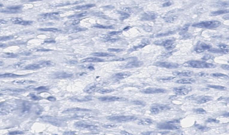 RNAscope® Multiplex Fluorescent Assay Options,Bio-Techne Corporation ...