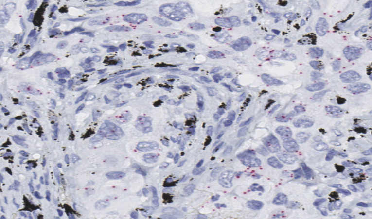 RNAscope® Multiplex Fluorescent Assay Options,Bio-Techne Corporation ...