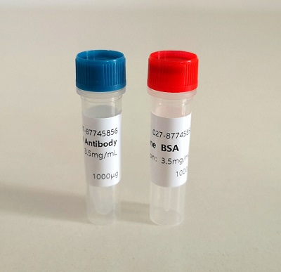 Vibrio Cholerae Inaba Monoclonal Antibody,specification,price,image-Bio ...
