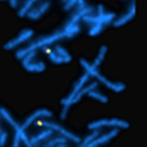 BRAF Break Apart FISH Probe,Empire Genomics_specification/price/image ...