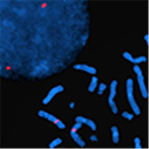 EGFR FISH Probe,specification,price,image-Bio-Equip in China