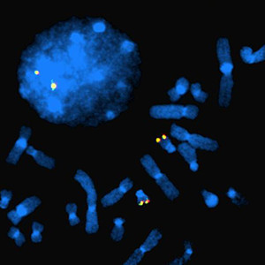 ERG Break Apart FISH Probe,Empire Genomics_specification/price/image ...