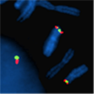 ETV1 Break Apart FISH Probe,Empire Genomics_specification/price/image ...