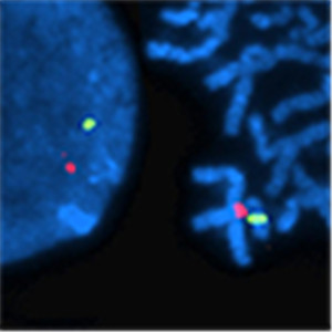 EWS-WT1 Probe Set,Empire Genomics_specification/price/image_Bio-Equip ...