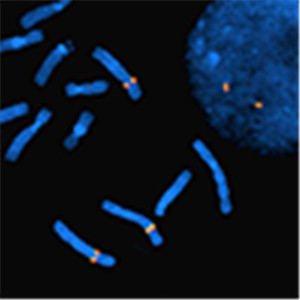 FGFR1 FISH Probe,Empire Genomics_specification/price/image_Bio-Equip in ...