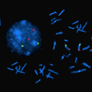 FGFR2 FISH Probe,Empire Genomics_specification/price/image_Bio-Equip in ...