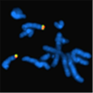 IGH Break Apart FISH Probe,Empire Genomics_specification/price/image ...