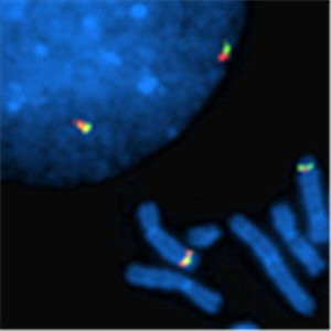MYC Break Apart FISH Probe,Empire Genomics_specification/price/image ...