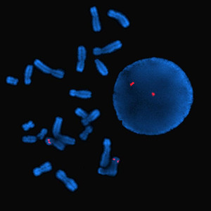 P16 (CDKN2A) FISH Probe,Empire Genomics_specification/price/image_Bio ...