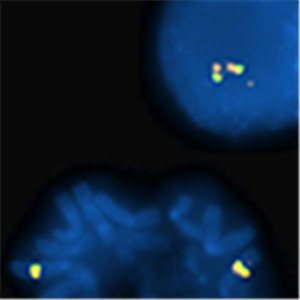 ROS1 Break Apart FISH Probe,Empire Genomics_specification/price/image ...
