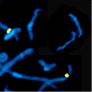 TFEB Break Apart FISH Probe,Empire Genomics_specification/price/image ...