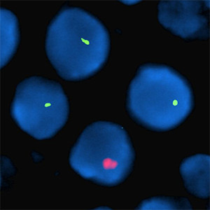 P16 (CDKN2A) FISH Probe,Empire Genomics_specification/price/image_Bio ...