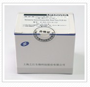 HEV IV Real Time RT-PCR Kit,ZJ Bio-Tech_specification/price/image_Bio ...