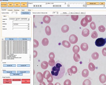 HemoQuest - Hematology Analysis Software,TissueGnostics_specification ...