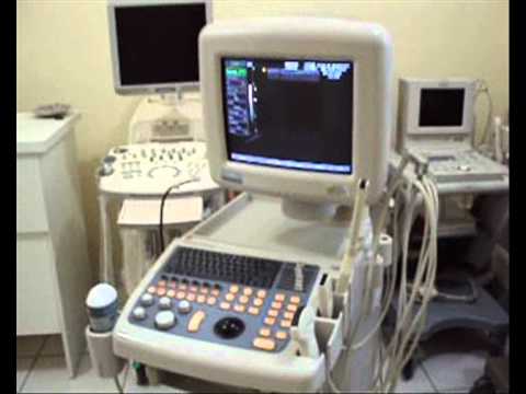 SAMSUNG MEDISON SonoAce 8000 Prome,Unison Bio-Medical Co.Ltd ...