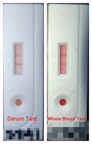 Foot and Mouth Disease (FMD)NSP Ab Test,SPAN BIOTECH LTD_specification ...